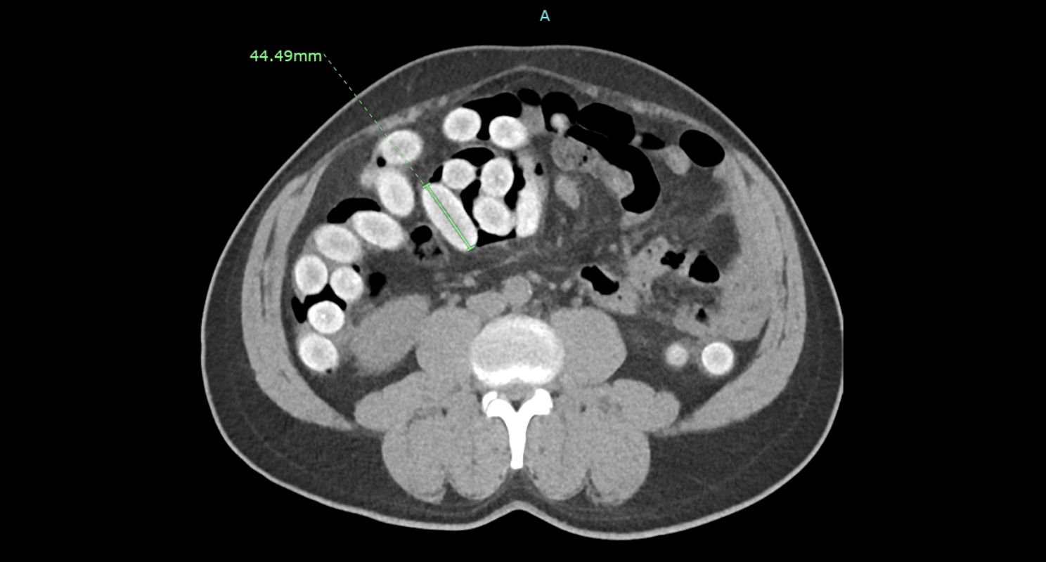 Kickstart a Crime-Fighting Radiography Career! | Explore Careers Australia